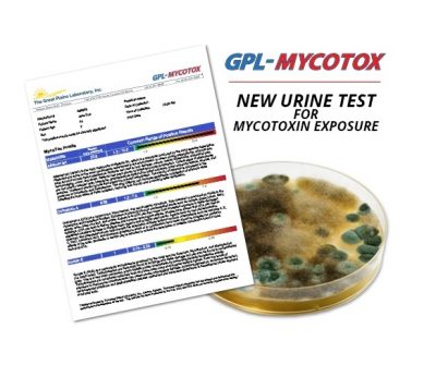 Mycotoxin Urine Testing - Advanced Naturopathic
